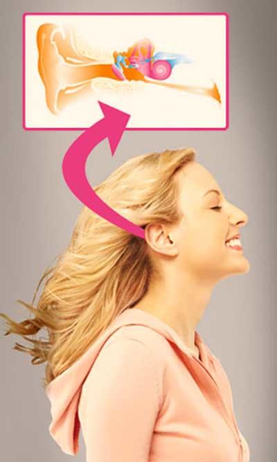 Mittelohr-Abbildung bei einer Frau